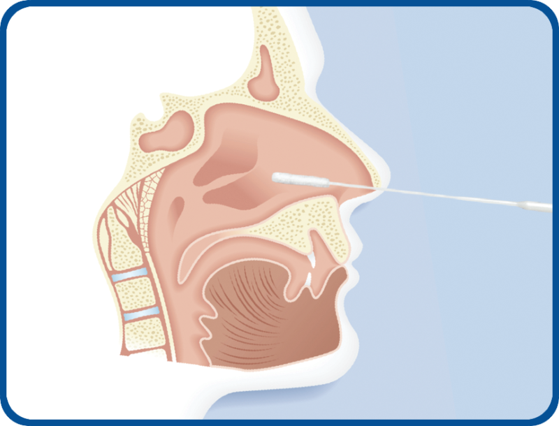 Specimen Collection Instructions - Ayass BioScience, Inc.